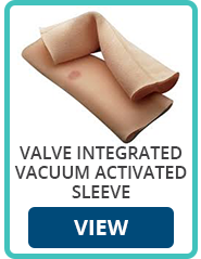 The Clinical Minute: ALPS Prosthetic Sleeves Overview