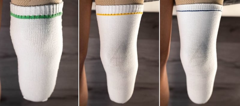 Manage Residual Limb Volume Changes Using ALPS Prosthetic Socks