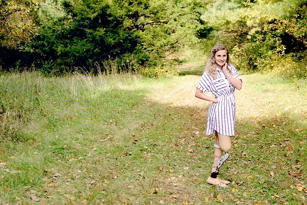 Things Amputees and People With Limb Differences Want You to Know, by ...