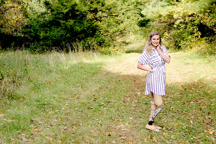 Things Amputees and People With Limb Differences Want You to Know, by ...