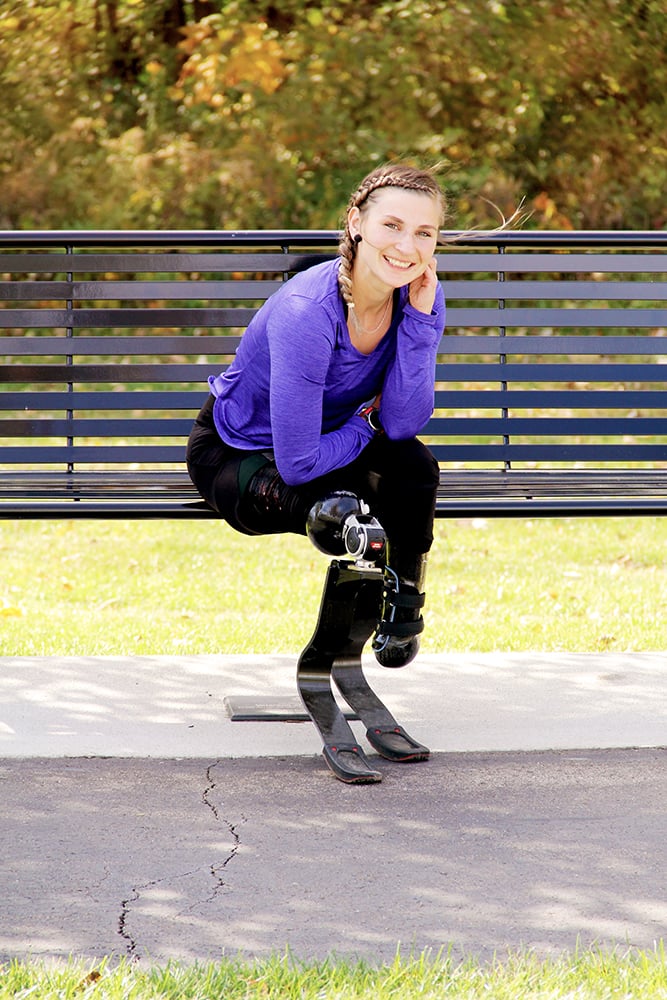 Things Amputees and People With Limb Differences Want You to Know, by ...