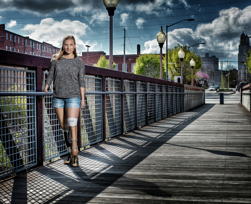 Top 10 Reasons Why It’s Great to Be an Amputee