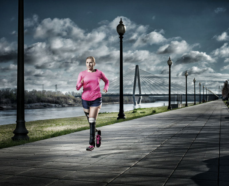 Top 10 Reasons Why It’s Great to Be an Amputee